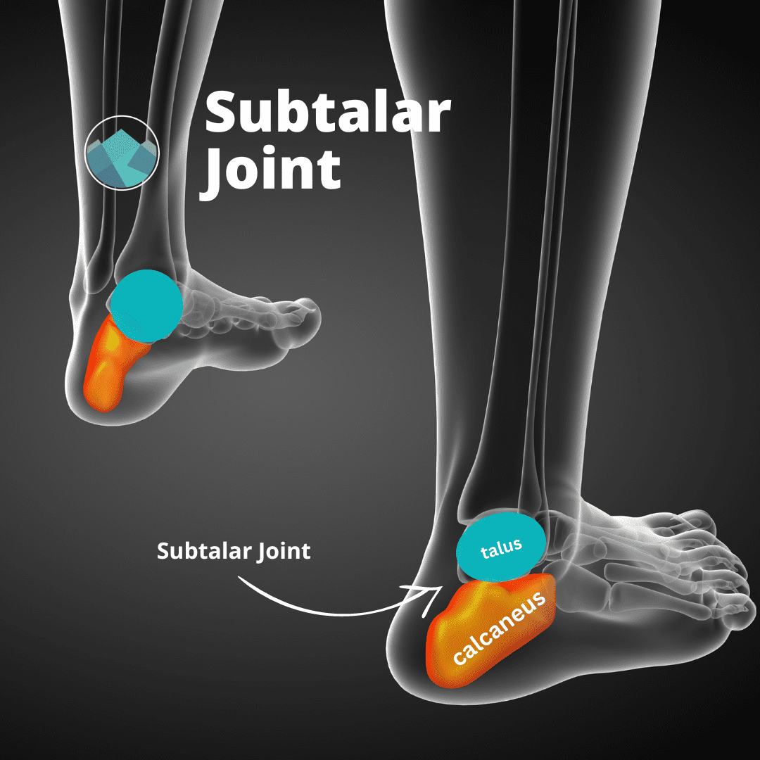 Subtalar Joint & Shoe Wear - UWS Connected Whole Health - UWS Connected ...